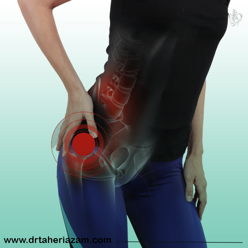 16 علت درد لگن و باسن - دلایل لگن درد در مردان و زنان چیست؟ | دکتر ...